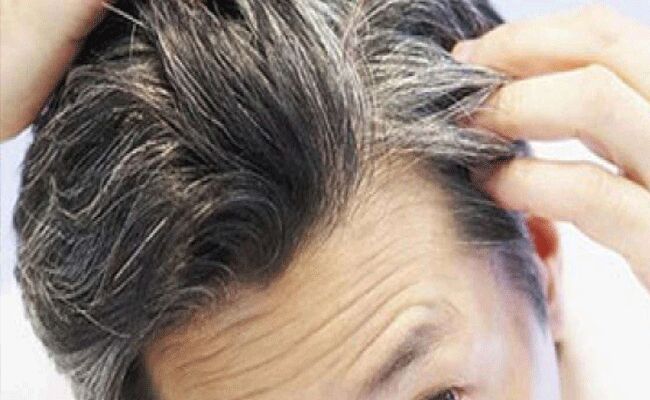 Grey Hair Control: తెల్లజుట్టు నివారణకు.. ఆహారంలో 6 విటమిన్లు..